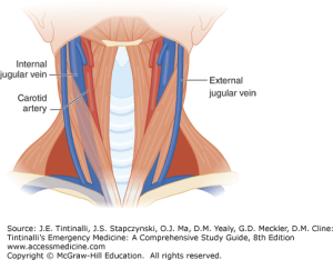 The Subclavian Line | Einstein Emergency Medicine
